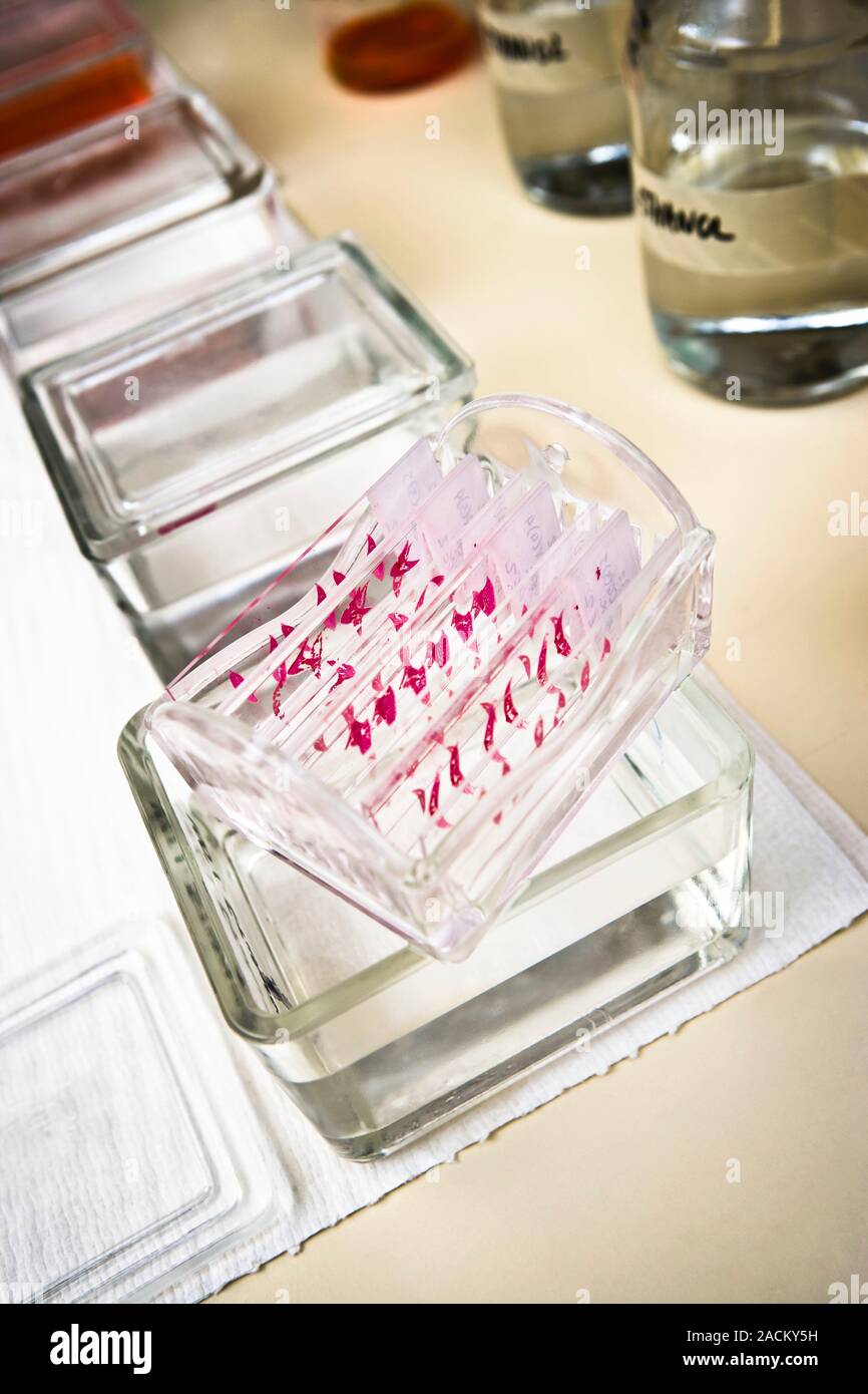 Cancer research laboratory. Samples in a biochemistry lab Stock Photo ...