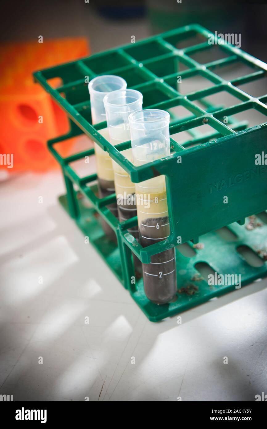 Cancer research laboratory. Samples in a biochemistry lab Stock Photo ...