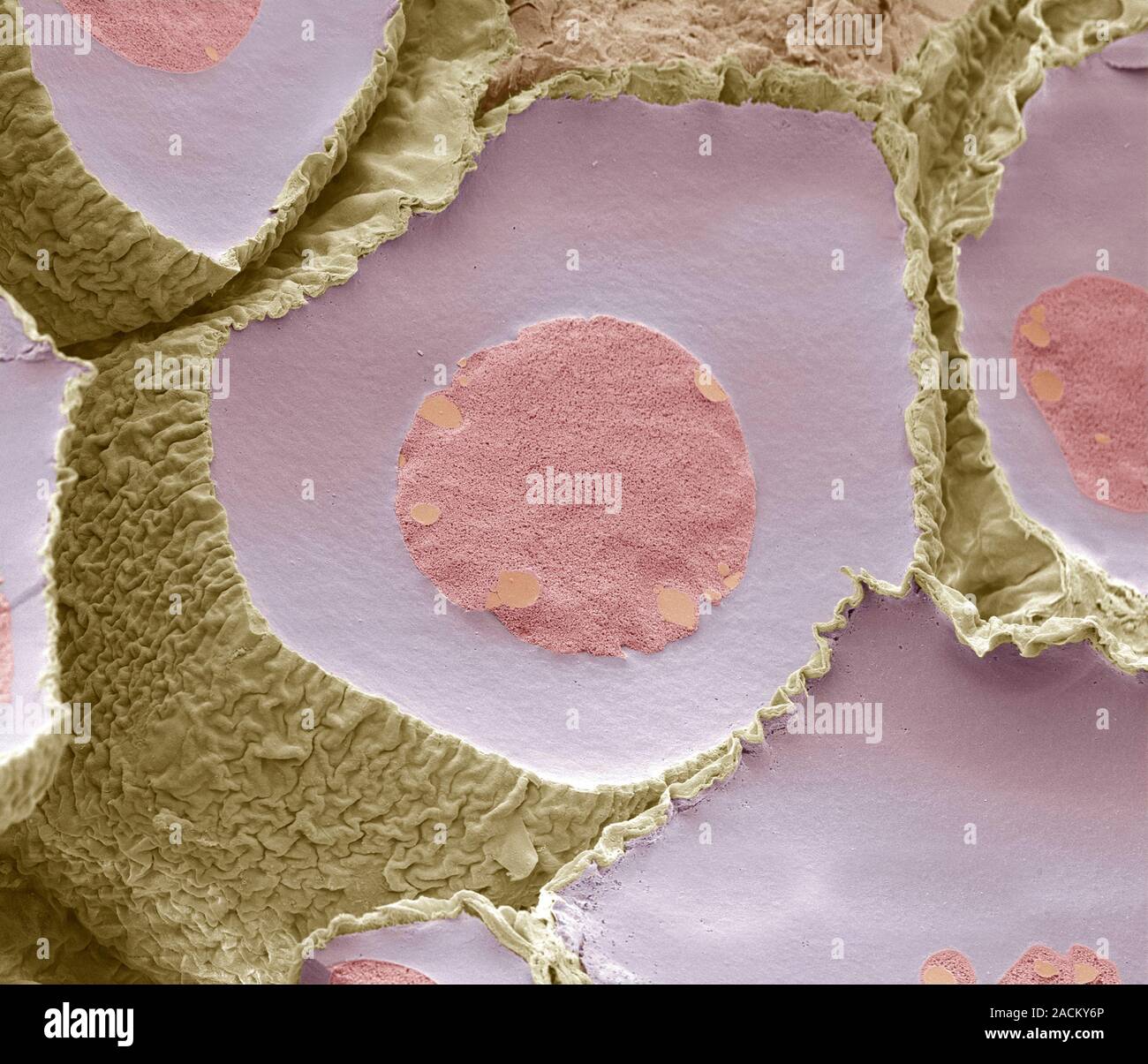 Frogspawn. Coloured scanning electron micrograph (SEM) of a section ...