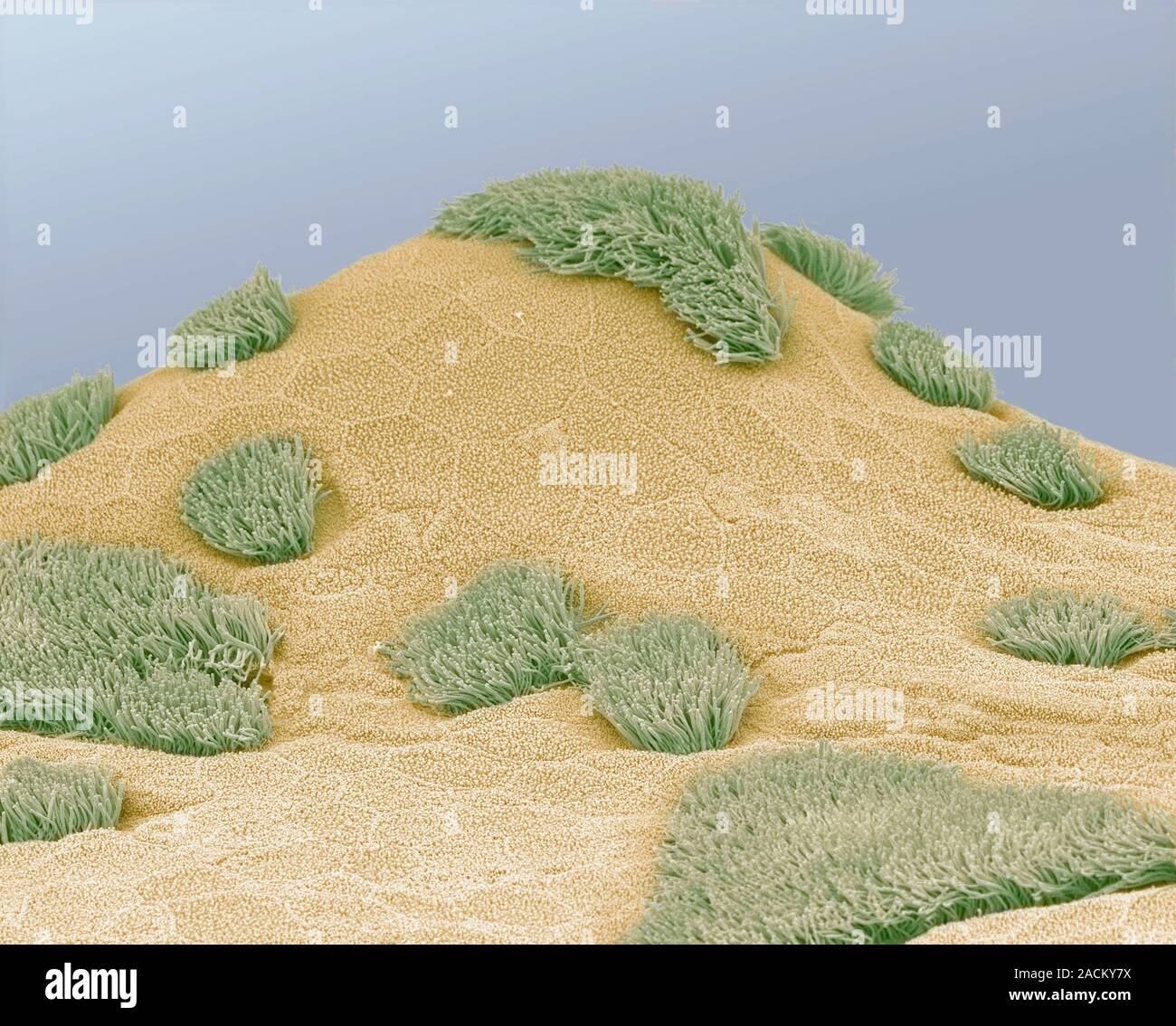 Nasal epithelium. Coloured scanning electron micrograph (SEM) of the ...