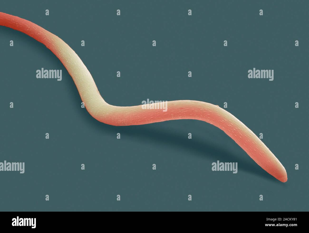Nematode worm. Coloured scanning electron micrograph (SEM) of a ...