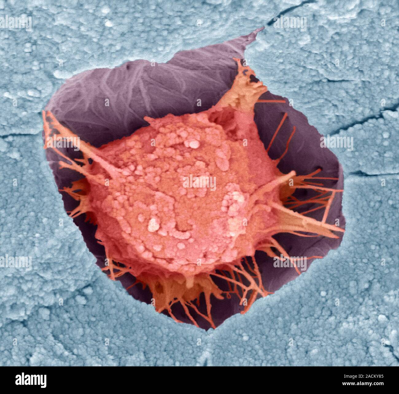 Osteoblast bone cell. Coloured scanning electron micrograph (SEM) of an ...