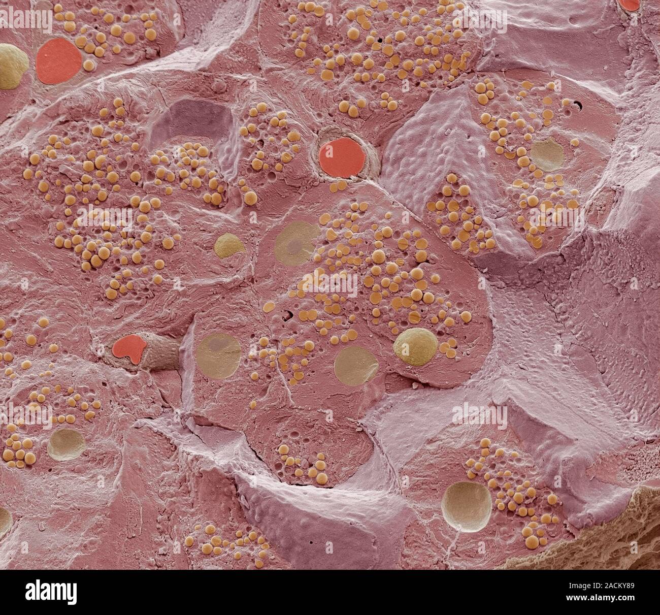 Pancreas tissue. Coloured scanning electron micrograph (SEM) of ...