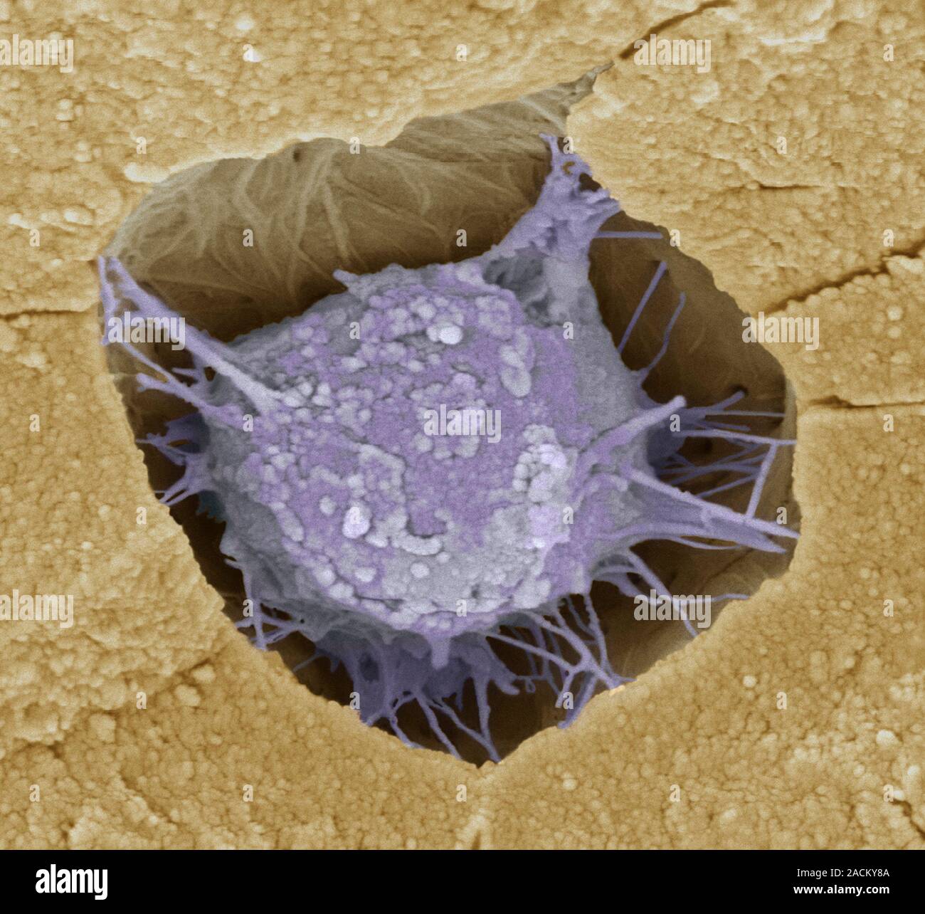 Osteoblast bone cell. Coloured scanning electron micrograph (SEM) of an osteoblast (centre) in ...