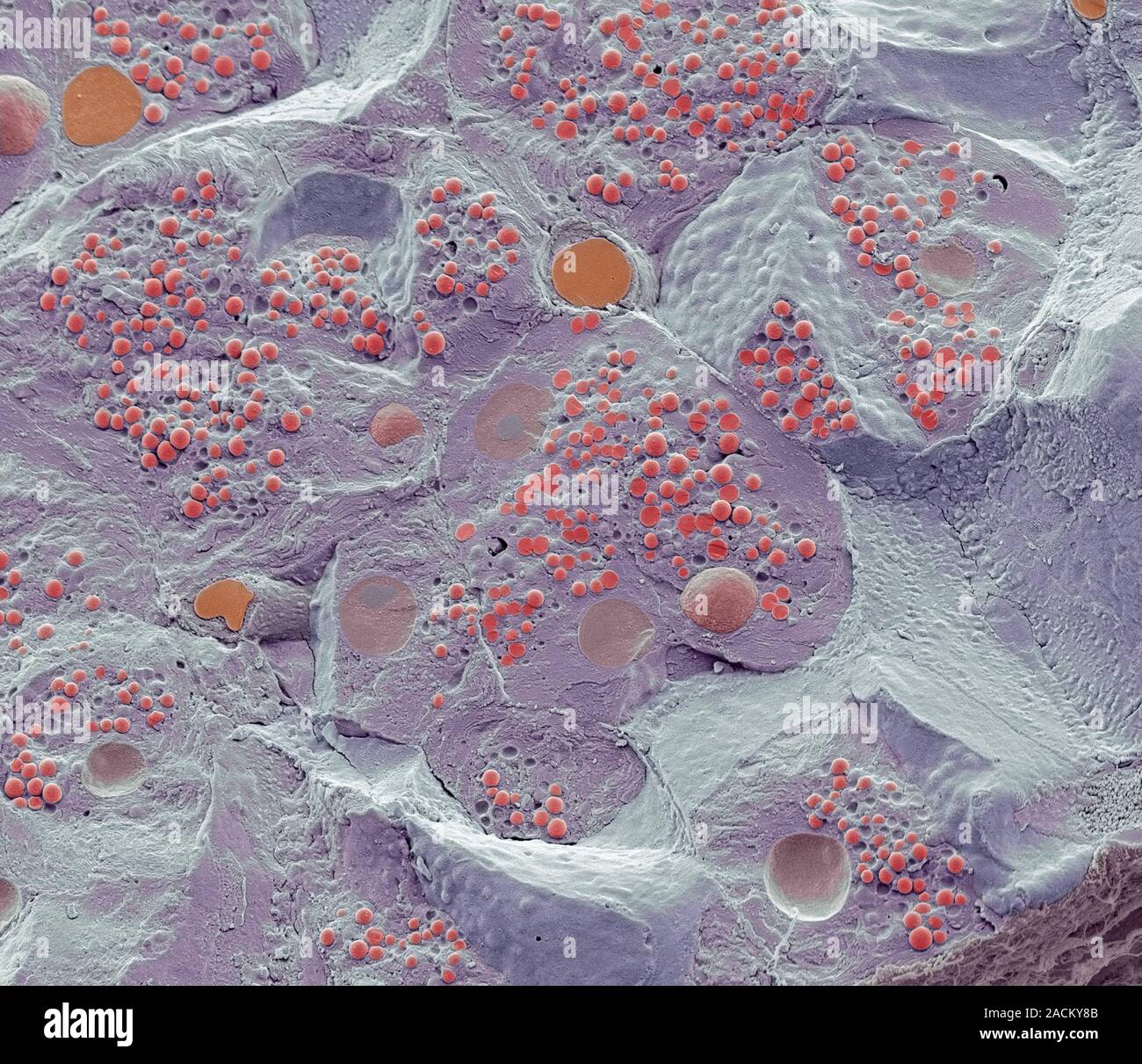 Pancreas tissue. Coloured scanning electron micrograph (SEM) of ...