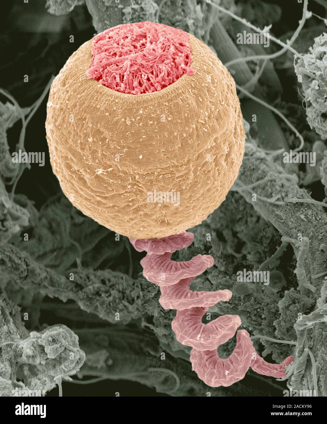 Vorticella protozoan. Coloured scanning electron micrograph (SEM) of a ... Vorticella protozoan. Coloured scanning electron micrograph (SEM) of a ...