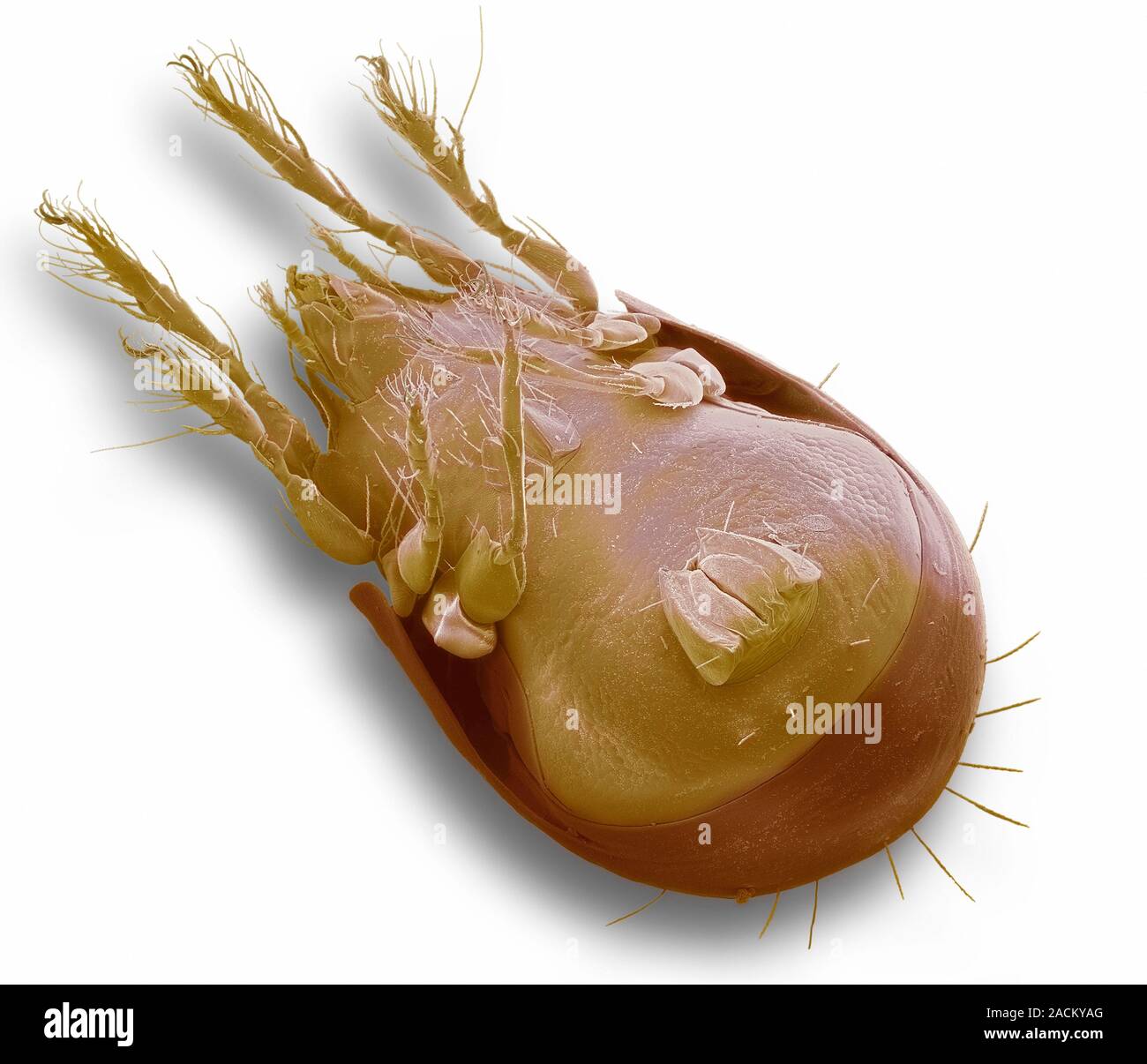 Soil mite. Coloured scanning electron micrograph (SEM) of a soil mite ...