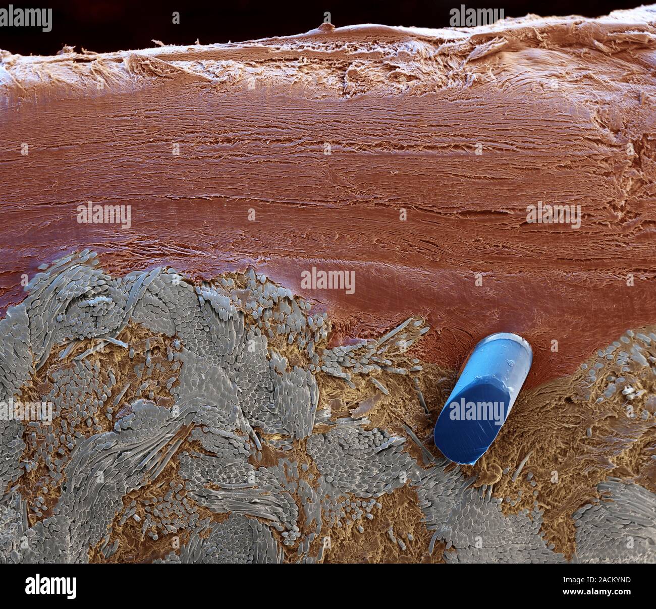 Aortic repair. Coloured scanning electron micrograph (SEM) of a stent ...