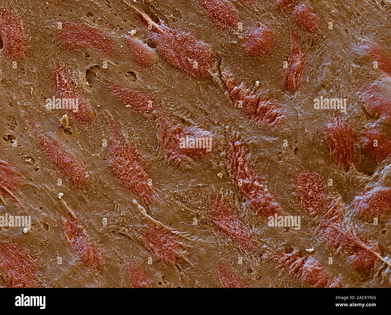Aortic repair. Coloured scanning electron micrograph (SEM) of the wall ...