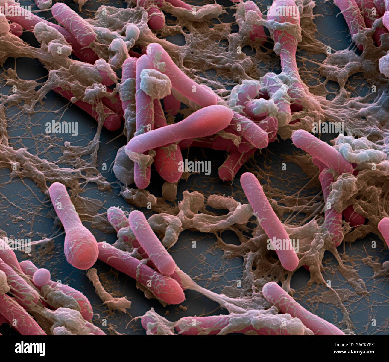 Clostridium botulinum bacteria. Coloured scanning electron micrograph ...