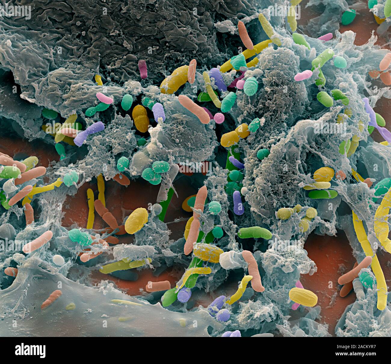 Faecal bacteria. Scanning electron micrograph (SEM) of various bacteria ...