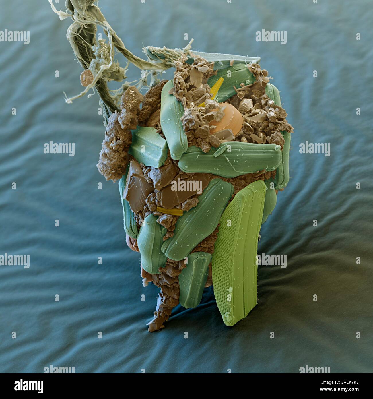 Diatoms in sediment. Scanning electron micrograph (SEM) of various ...