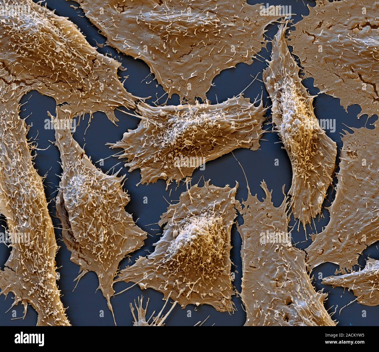 CHO cells. Coloured scanning electron micrograph of cultured Chinese ...