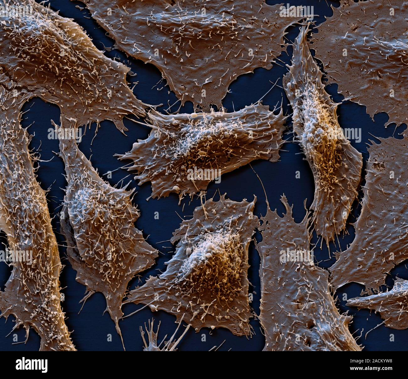 CHO cells. Coloured scanning electron micrograph of cultured Chinese ...
