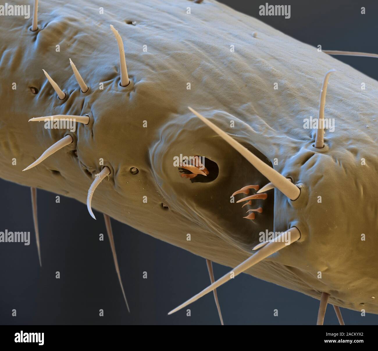 Tick leg. Coloured scanning electron micrograph (SEM) of a Haller's ...