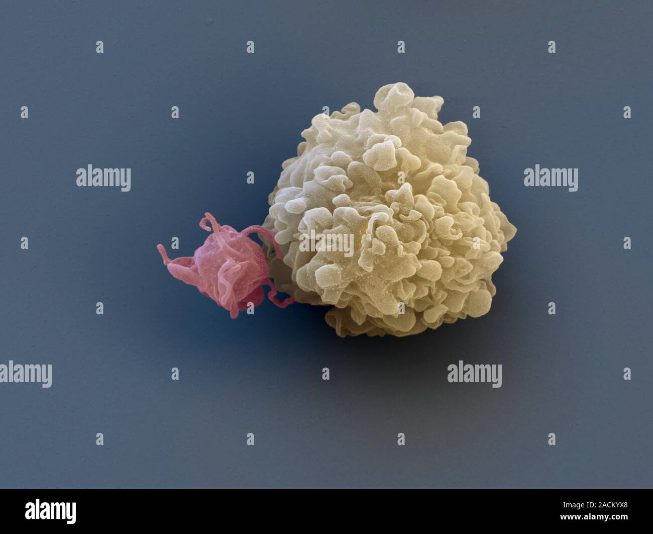 Human blood cells. Coloured scanning electron micrograph (SEM) of a ...