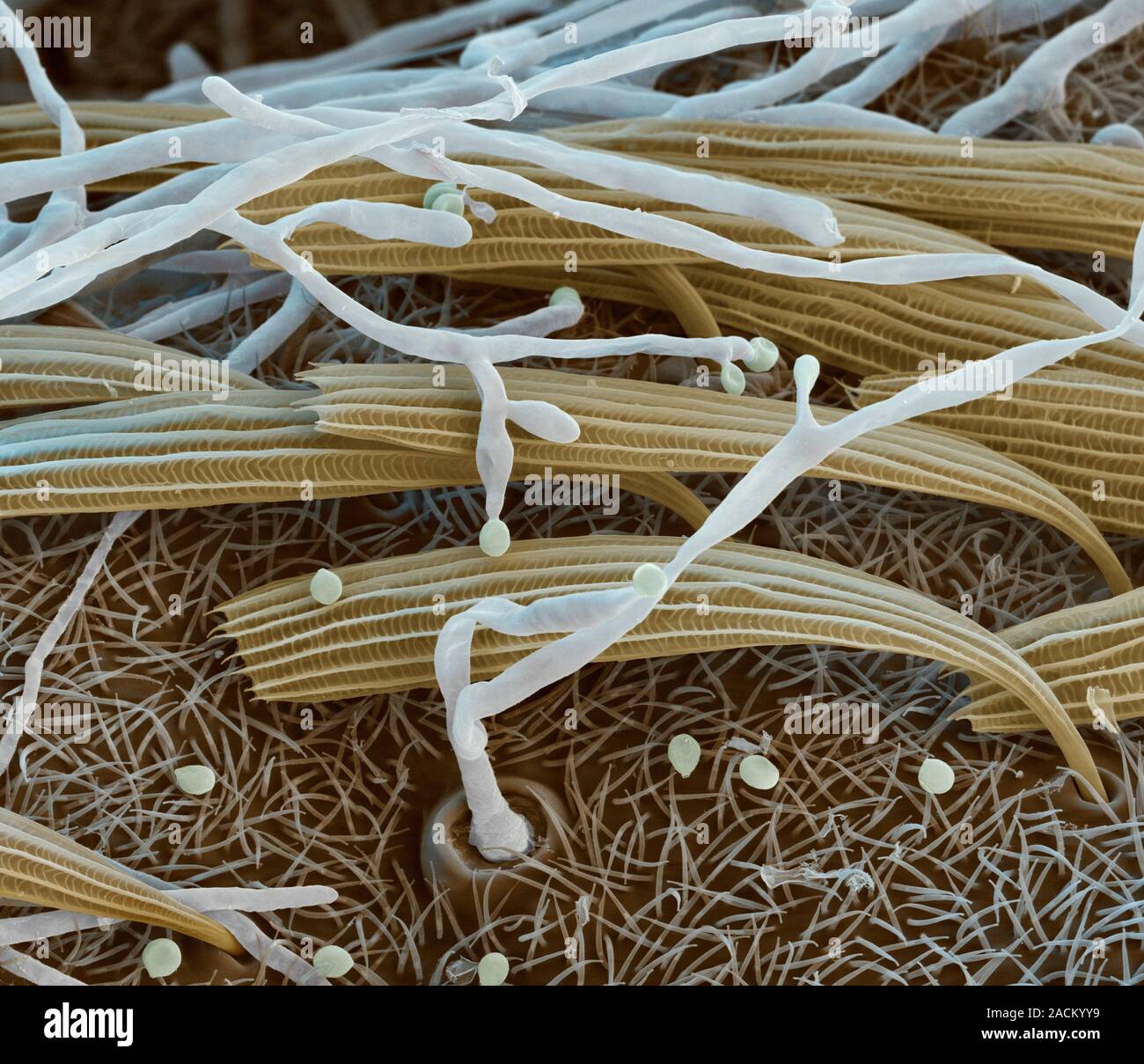 Fungal parasite on mosquito larva. Coloured scanning electron ...