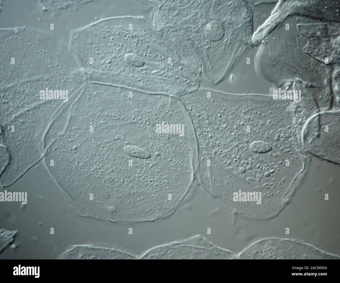 Mouth epithelial cells. Light micrograph of squamous epithelial cells ...