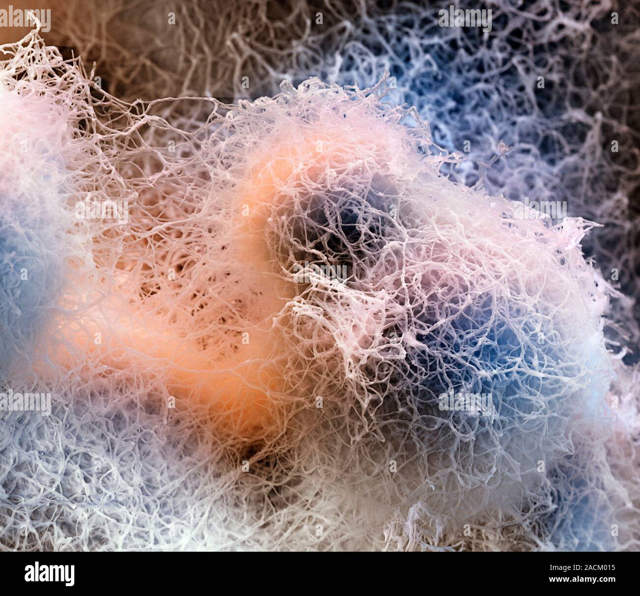 Nanofoam material, coloured scanning electron micrograph (SEM). This ...