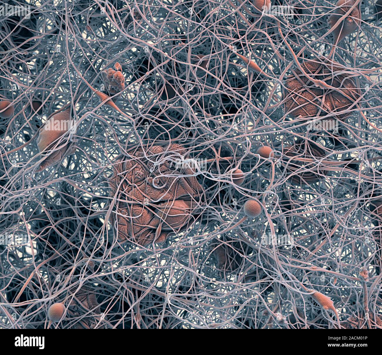 Microsphere filter. Scanning electron micrograph (SEM) of chemically ...