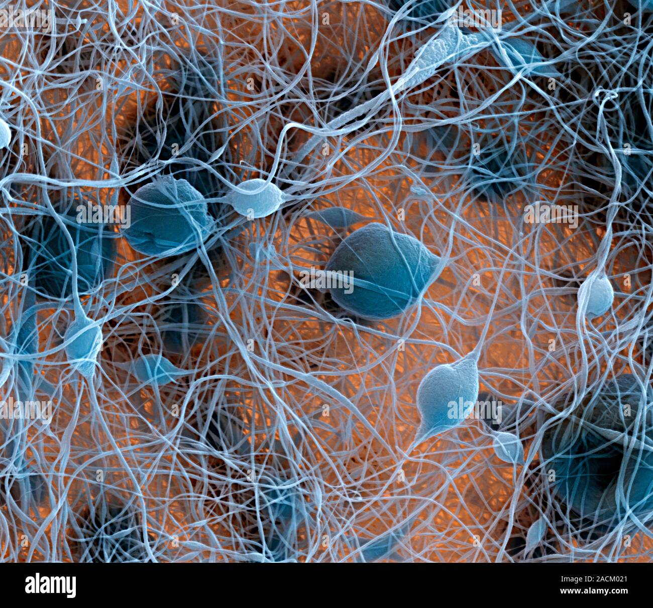 Microsphere filter. Scanning electron micrograph (SEM) of chemically ...