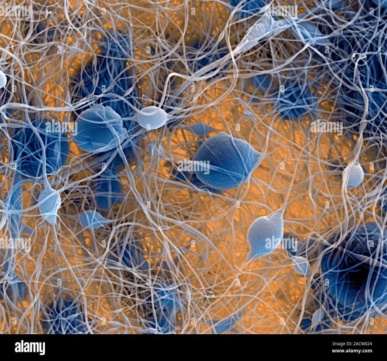 Microsphere filter. Scanning electron micrograph (SEM) of chemically ...