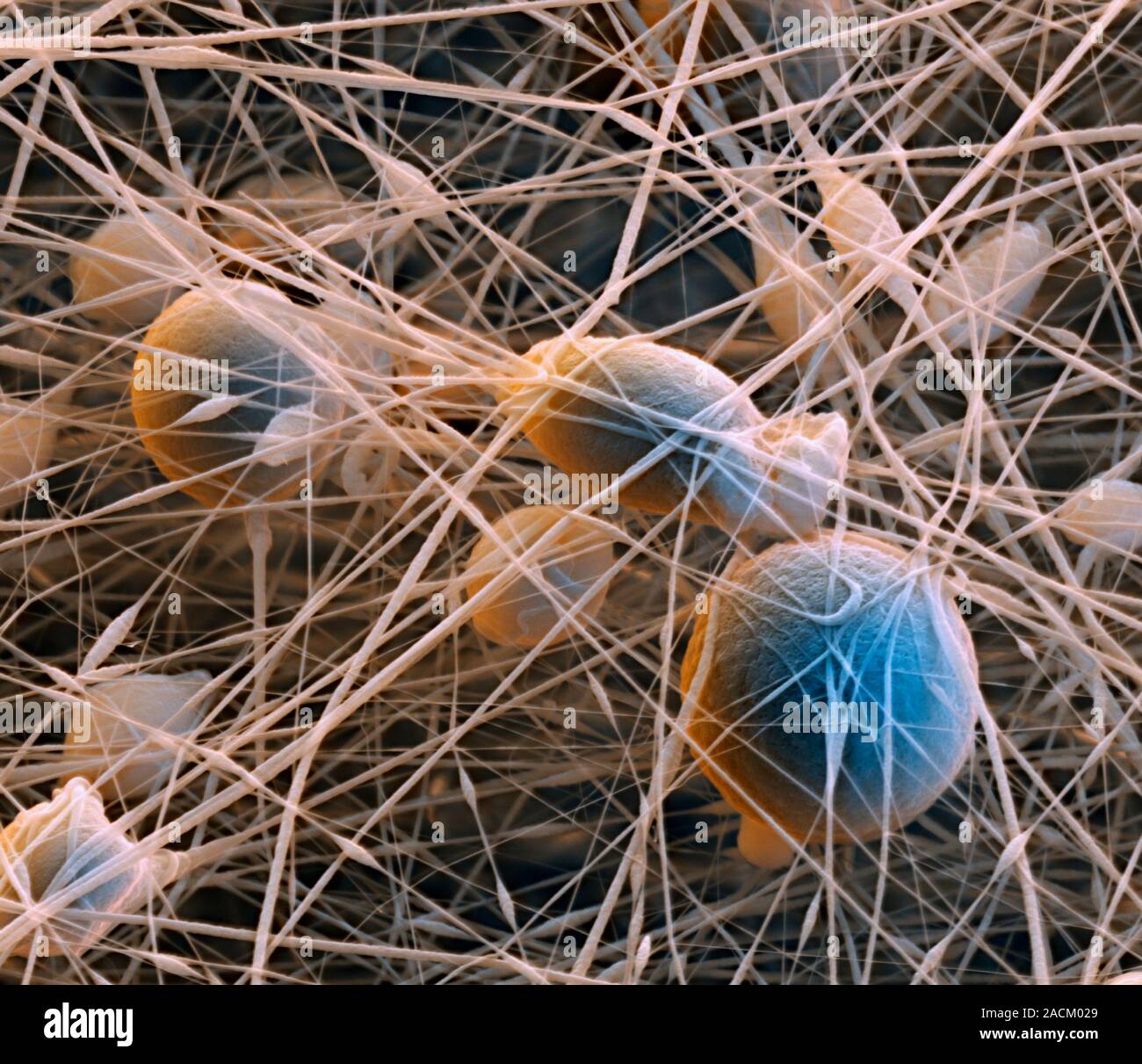 Microsphere filter. Scanning electron micrograph (SEM) of chemically ...