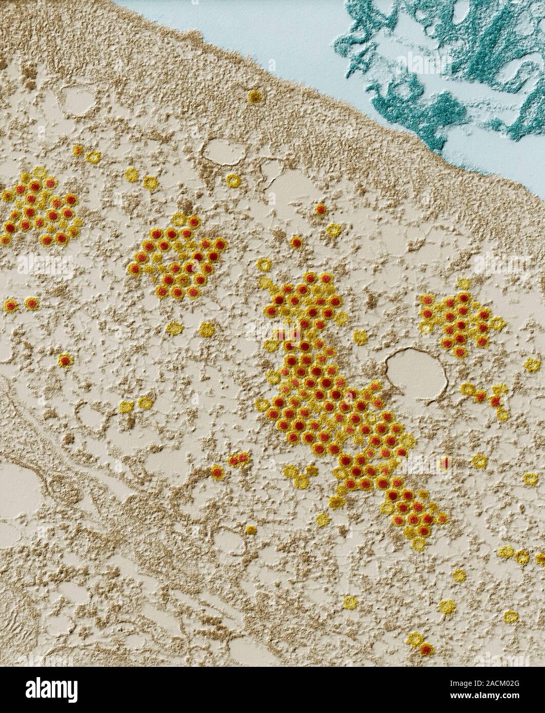 Rotavirus particles. Coloured transmission electron micrograph (TEM) of ...