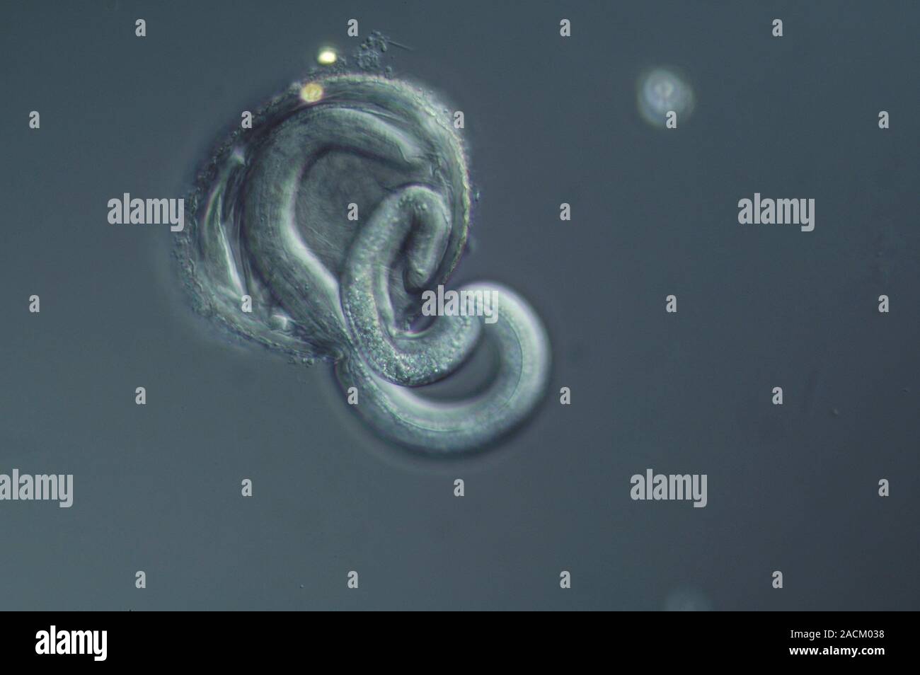 Dog roundworm hatching. Light micrograph of a dog roundworm (Toxocara ...