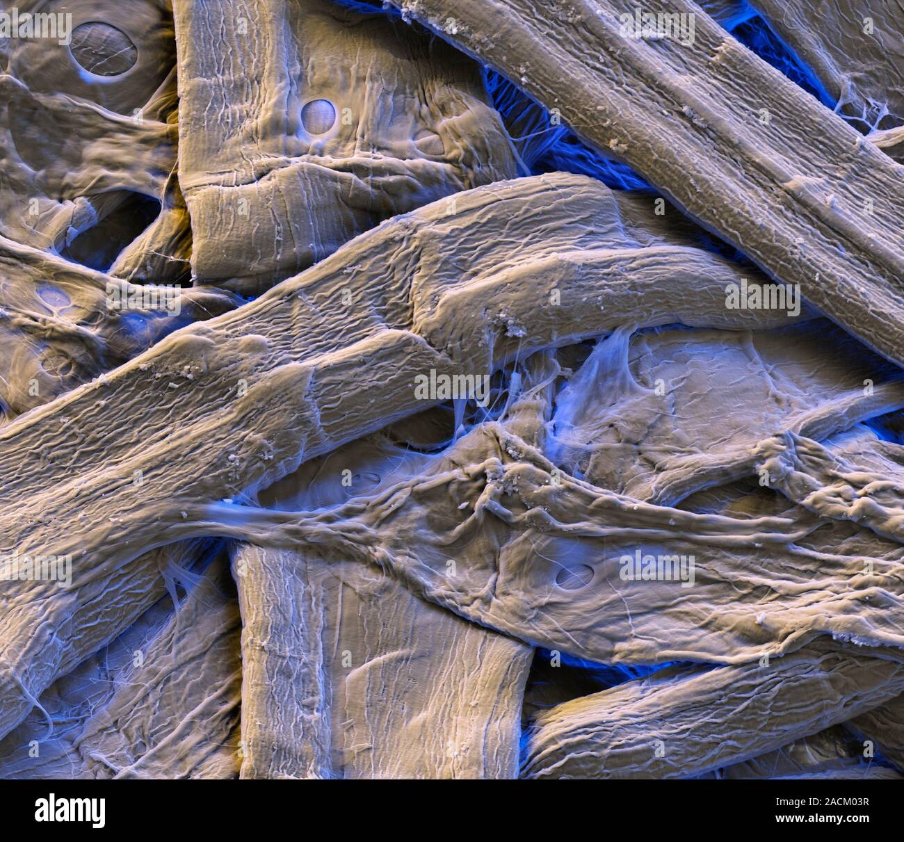 Nanocellulose mat. Coloured scanning electron micrograph (SEM) of ...