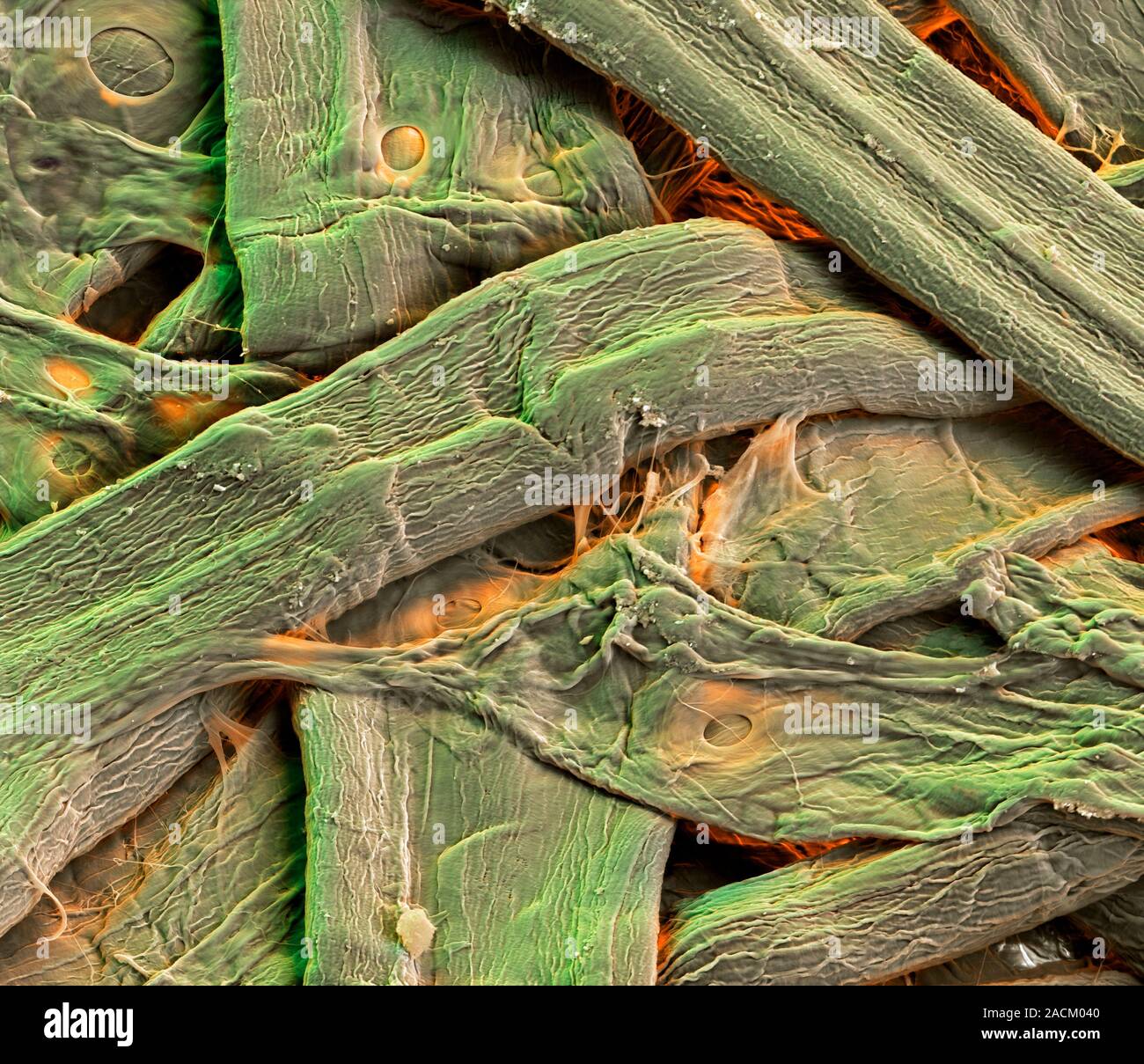 Nanocellulose mat. Coloured scanning electron micrograph (SEM) of ...