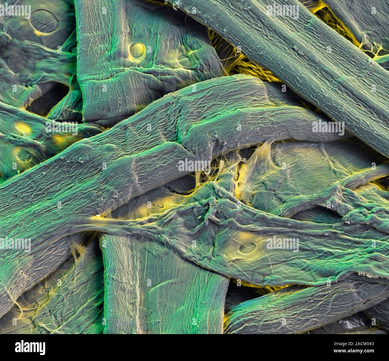 Nanocellulose mat. Coloured scanning electron micrograph (SEM) of ...