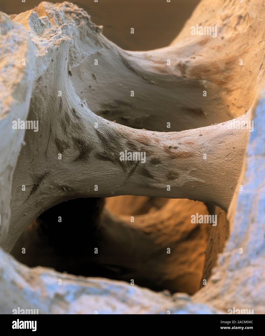 Cow bone. Coloured scanning electron micrograph (SEM) showing the ...