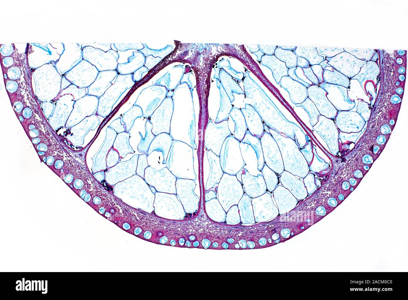 Orange fruit. Light micrograph of a section through the fruit of a ...