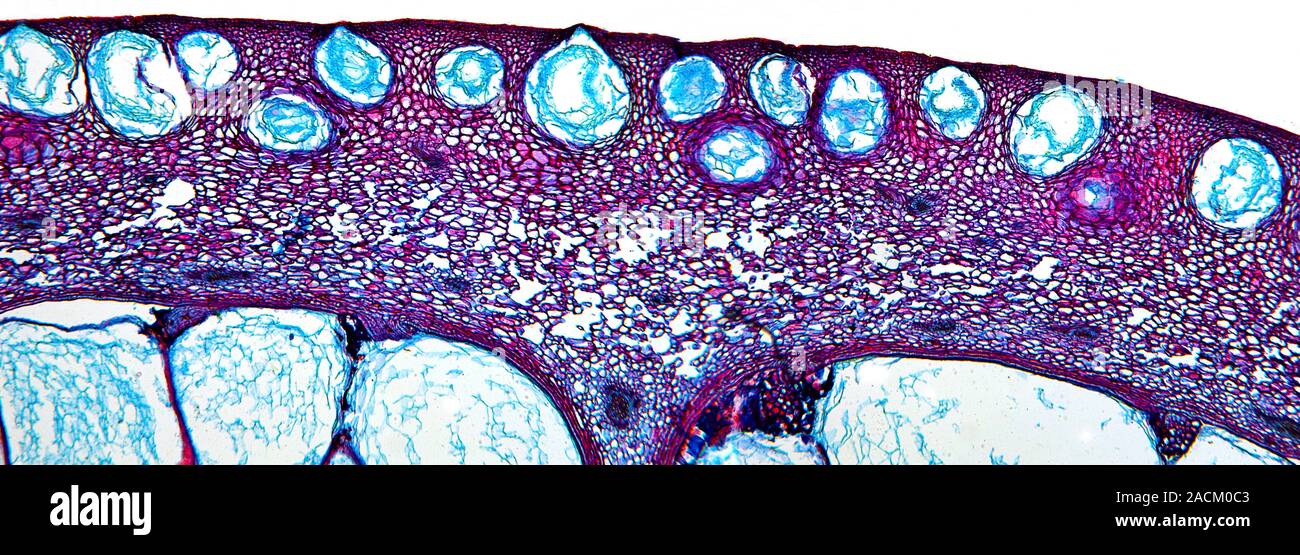 Orange fruit. Light micrograph of a section through the rind of a fruit ...