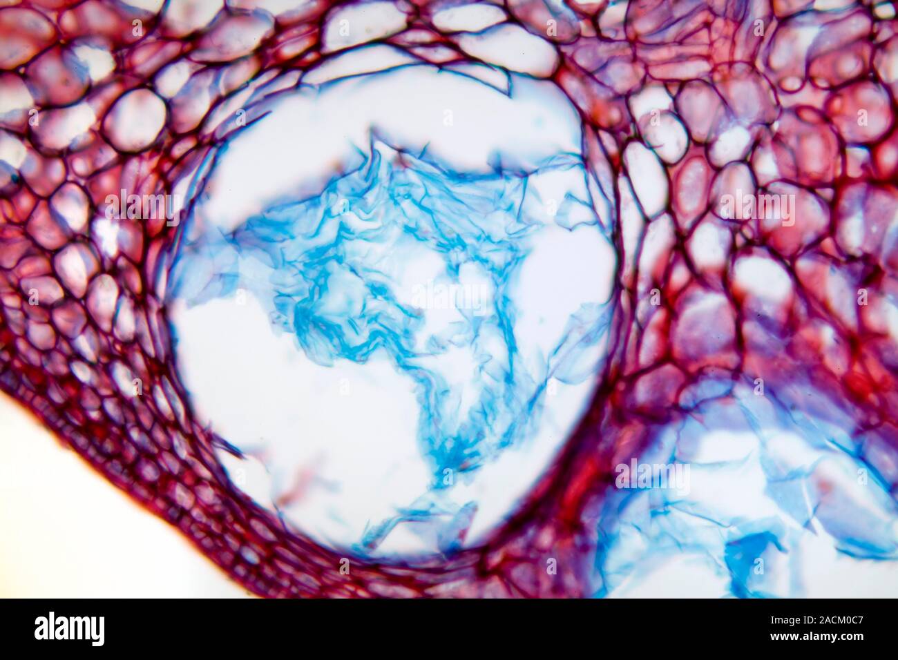Orange fruit. Light micrograph of a section through the rind of a fruit ...