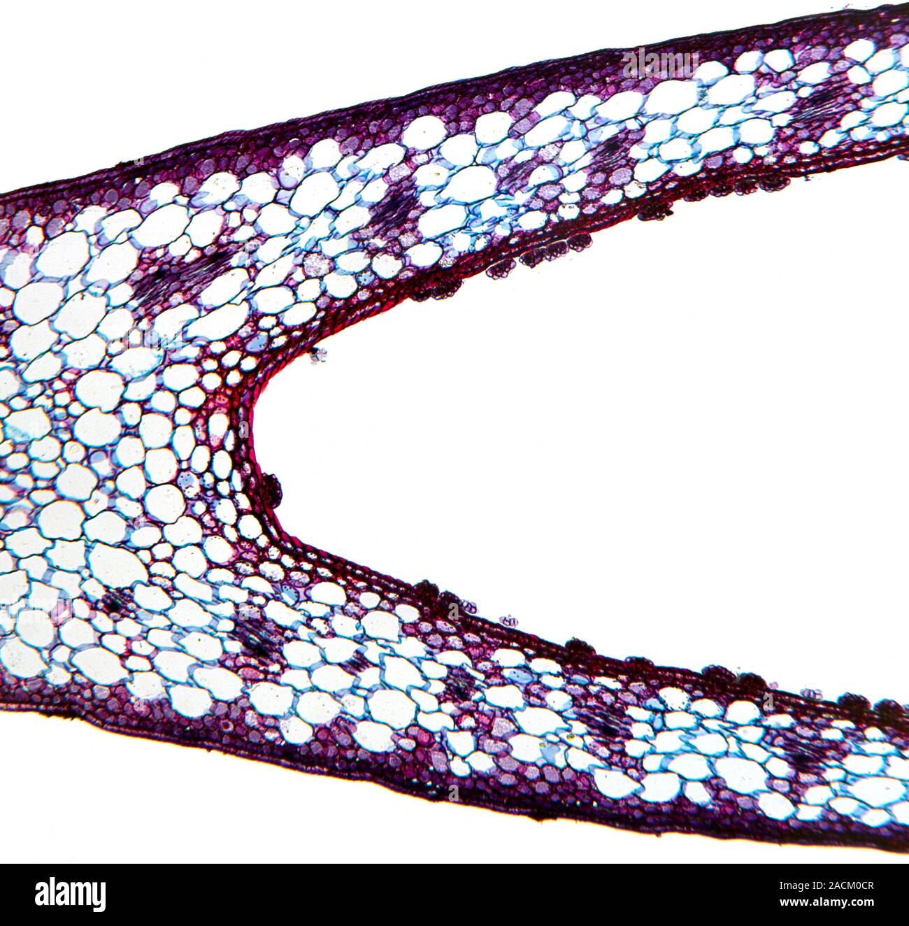 Venus flytrap leaf. Light micrograph of a section through the leaf of a ...