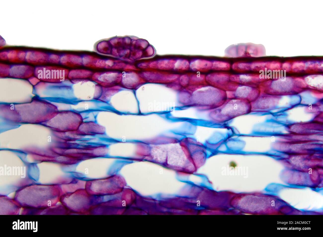 Venus flytrap leaf. Light micrograph of a section through the leaf of a ...