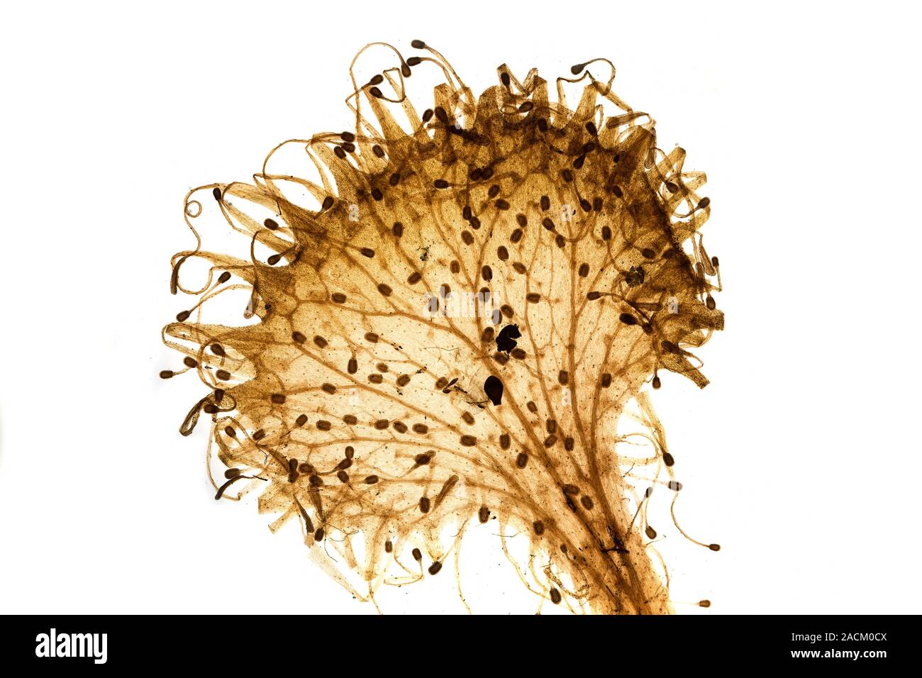 Common sundew. Light micrograph of a section through the leaf of a ...