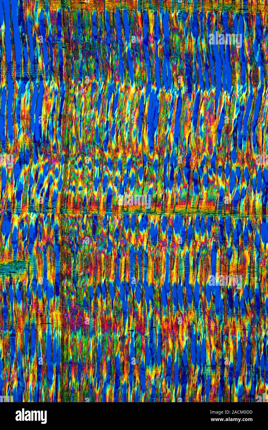Beech tree stem. Polarised light micrograph of a section through the ...