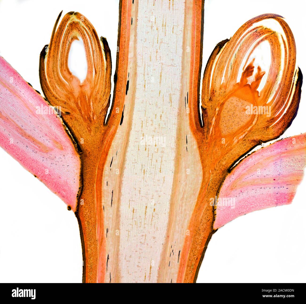 Sycamore leaf in autumn. Light micrograph of a section through the stem ...