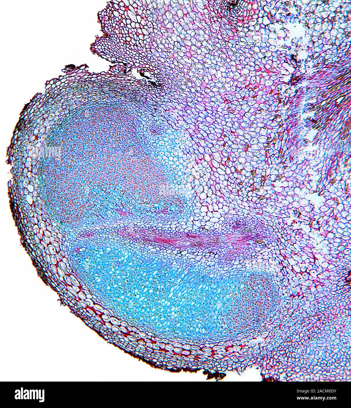 Lupin root nodules. Light micrograph of a section through the root ...