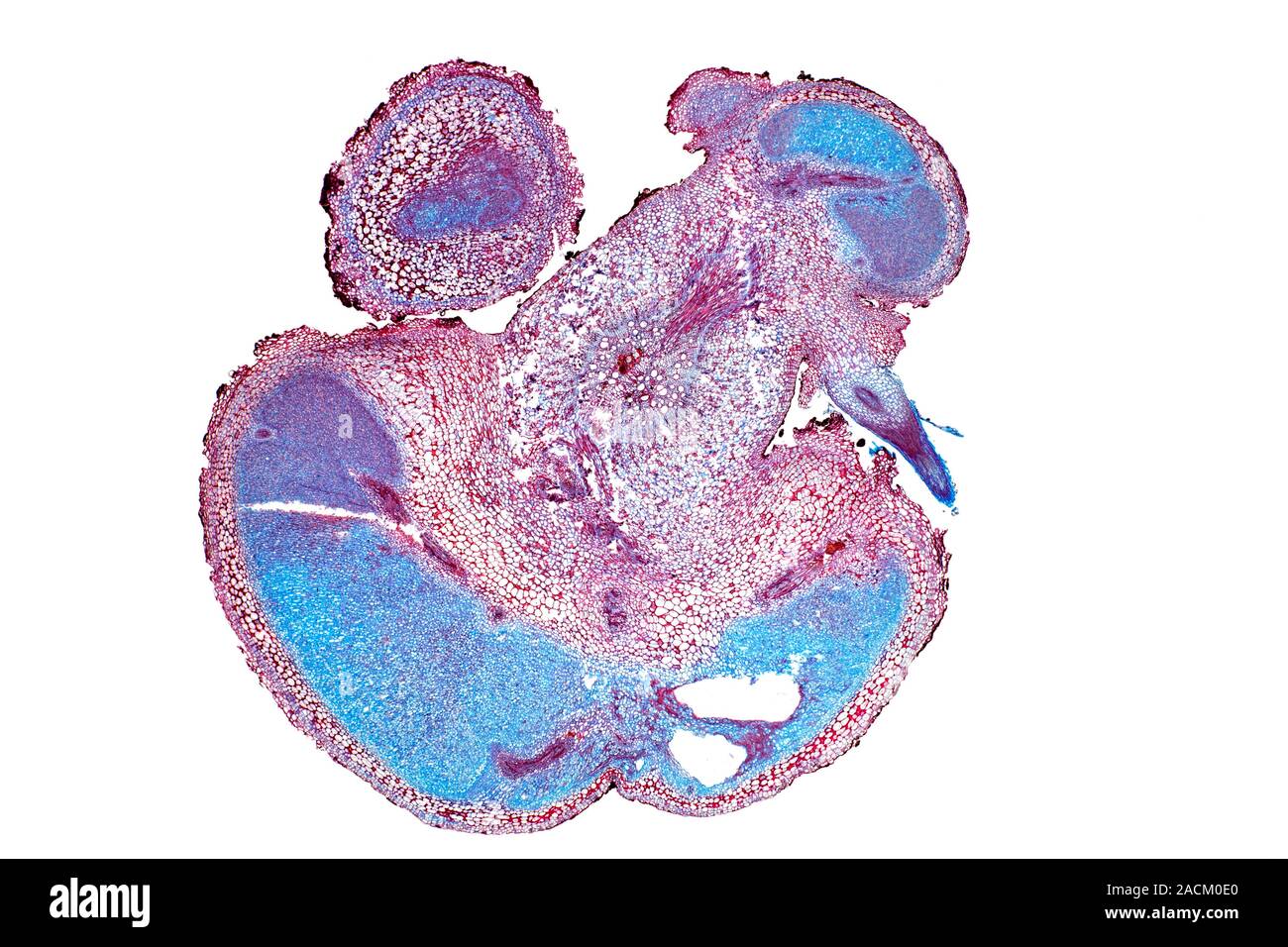 Lupin root nodules. Light micrograph of a section through the root ...