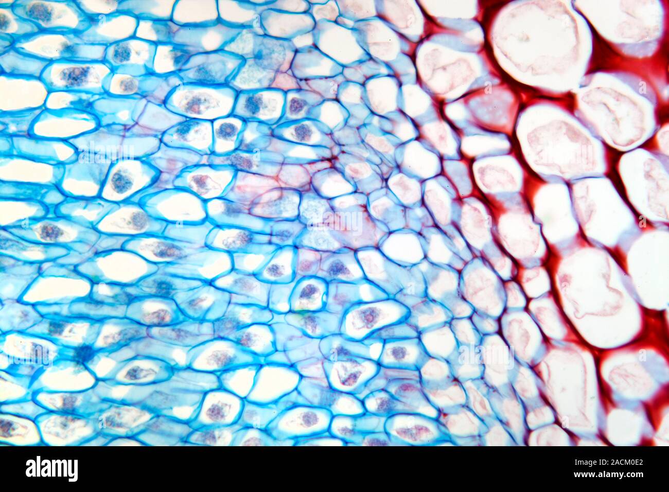 Lupin root nodules. Light micrograph of a section through the root ...