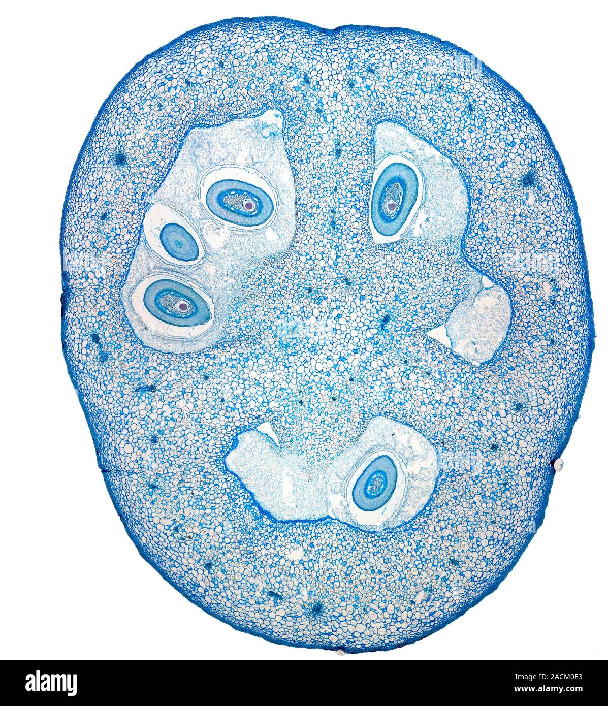 Tomato fruit. Light micrograph of a section through the young fruit of ...