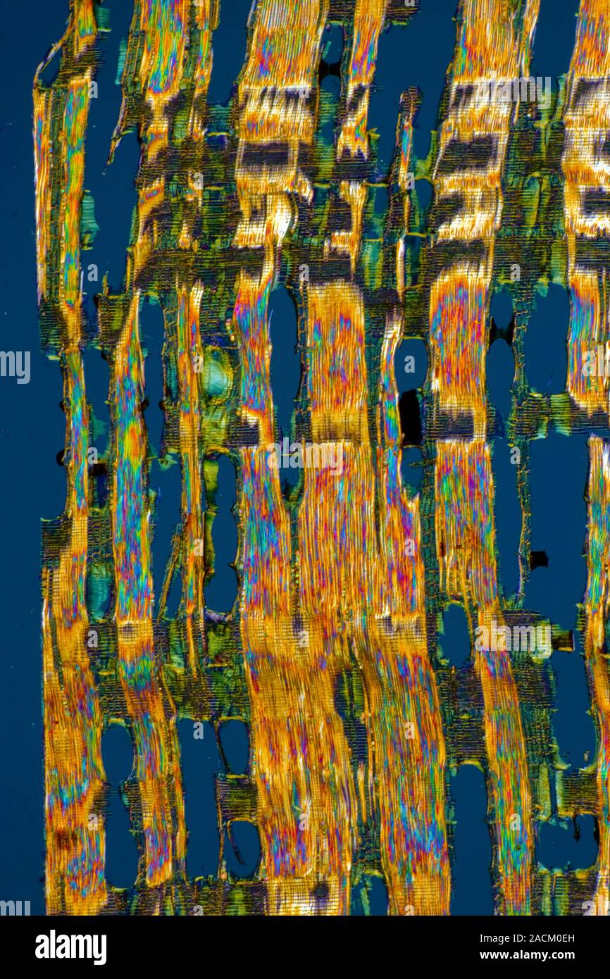 African teak woody stem. Polarised light micrograph of a section ...