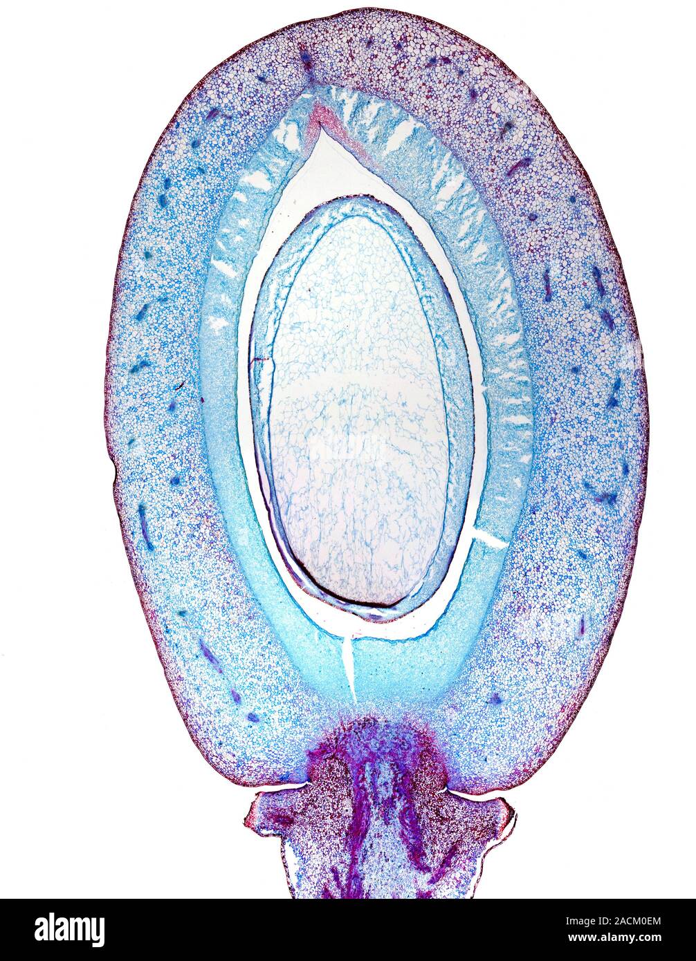 Bean pod. Light micrograph of a section through the seed pod of a bean ...