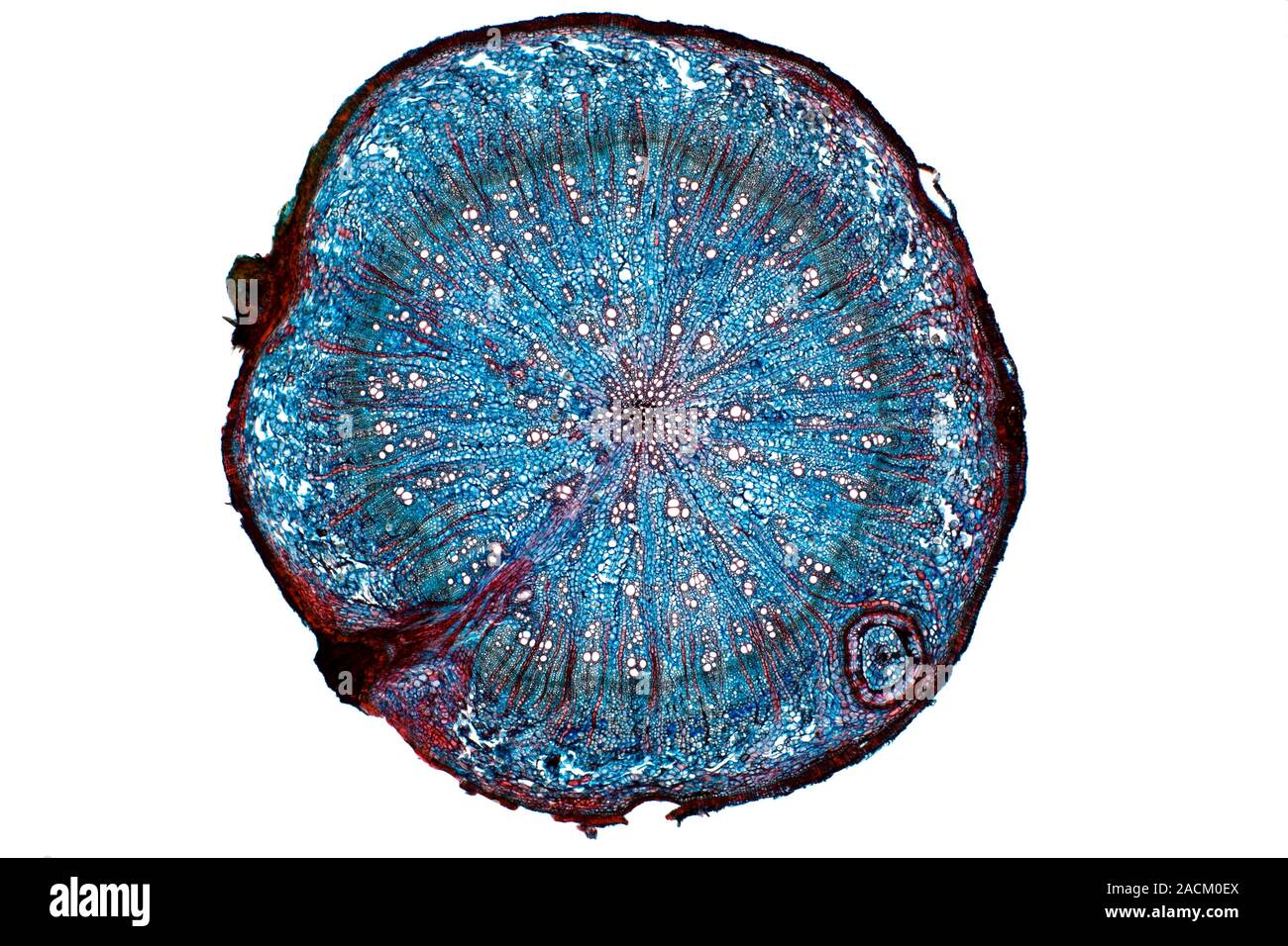 Rhubarb root. Light micrograph of a section through the root of a ...