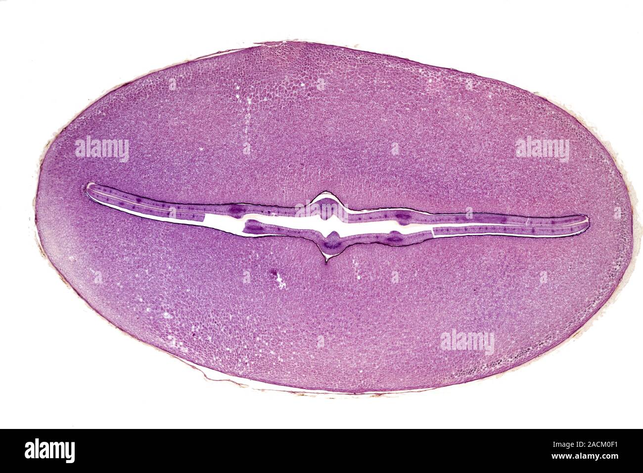 Castor oil plant seed. Light micrograph of a section through the seed ...