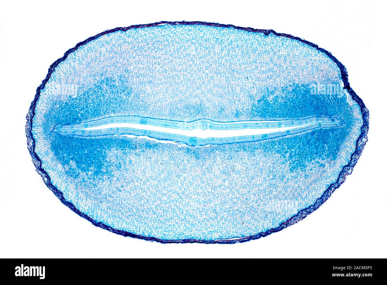 Castor oil plant seed. Light micrograph of a section through the seed ...